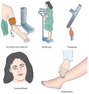 Finger test for Necrotizing Fascitis | Epomedicine