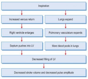 Pulsus Paradoxus - Clinical Examination | Epomedicine