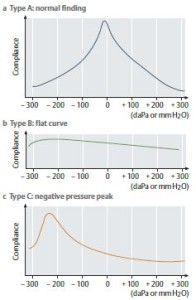 Understanding and Interpreting a Tympanogram | Epomedicine