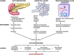 Acute Pancreatitis - Case Discussion | Epomedicine