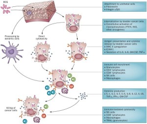 BCG for Urinary Bladder Cancer and BCG sepsis | Epomedicine