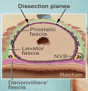 Prostate - Applied Anatomy | Epomedicine
