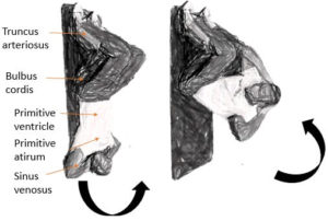 Heart Development - Embryology Made Easy | Epomedicine