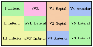 Acute STEMI Management - Mnemonic based approach | Epomedicine