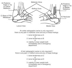 Ottawa Foot, Ankle and Knee rules - Mnemonic | Epomedicine