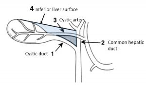 Calot’s triangle : Mnemonic | Epomedicine