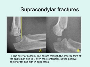 Lines and Angles in Orthopedics | Epomedicine