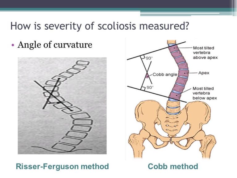 Lines and Angles in Orthopedics | Epomedicine