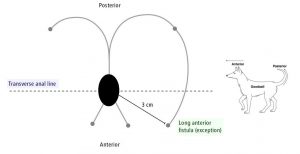 Goodsall’s rule : Mnemonic | Epomedicine