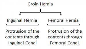 Hernia - Inguinal Hernia | Epomedicine