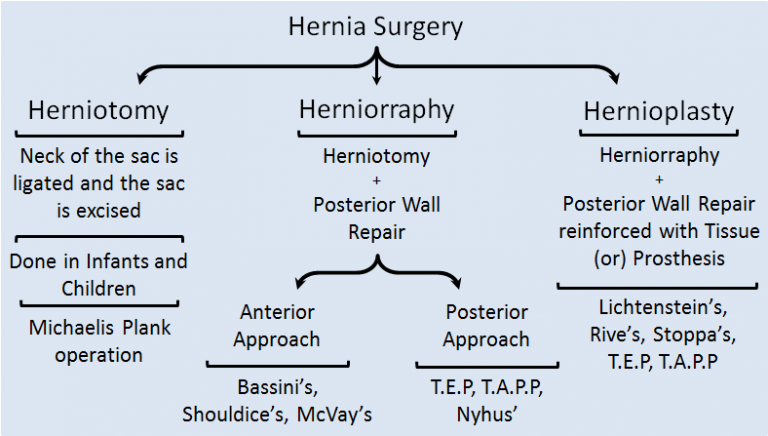 Hernia - Inguinal Hernia | Epomedicine