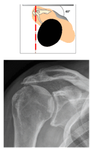 Shoulder X-ray views | Epomedicine