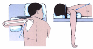 Shoulder X-ray views | Epomedicine