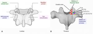 Pedicle Screw Insertion Simplified | Epomedicine