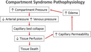 Pathophysiology of Acute Compartment syndrome | Epomedicine