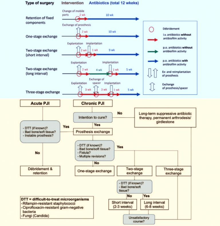 Periprosthetic Joint Infection (PJI) Criteria and Management | Epomedicine