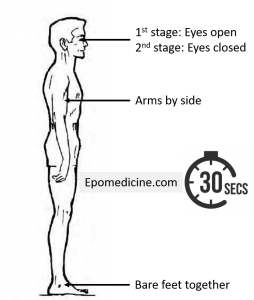 Romberg test | Epomedicine