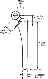 THA dislocation : WHAT mnemonic | Epomedicine