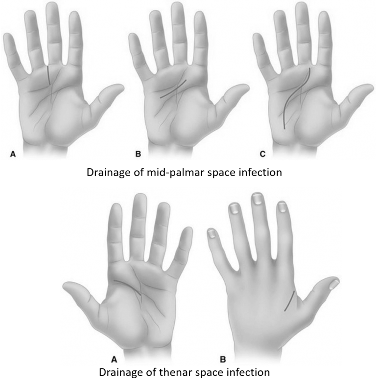 Spaces and Compartments of Hand | Epomedicine