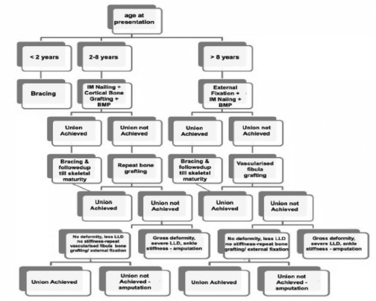 Congenital Pseudoarthrosis of Tibia (CPT) | Epomedicine