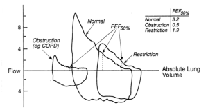 Flow-Volume Loop : Mnemonics | Epomedicine