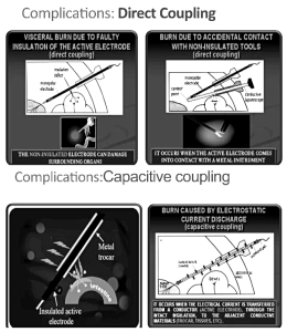 Electrosurgery Notes | Epomedicine