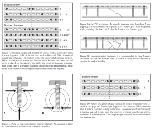 Biomechanics in MIPO (Minimally Invasive Plate Osteosynthesis ...