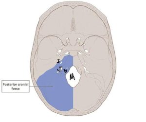 Posterior Cranial Fossa : Mnemonic | Epomedicine