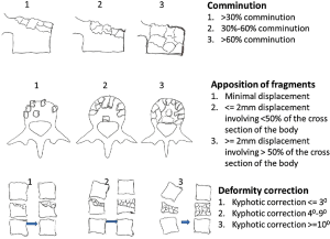 McCormack Load Sharing Classification (LSC) | Epomedicine